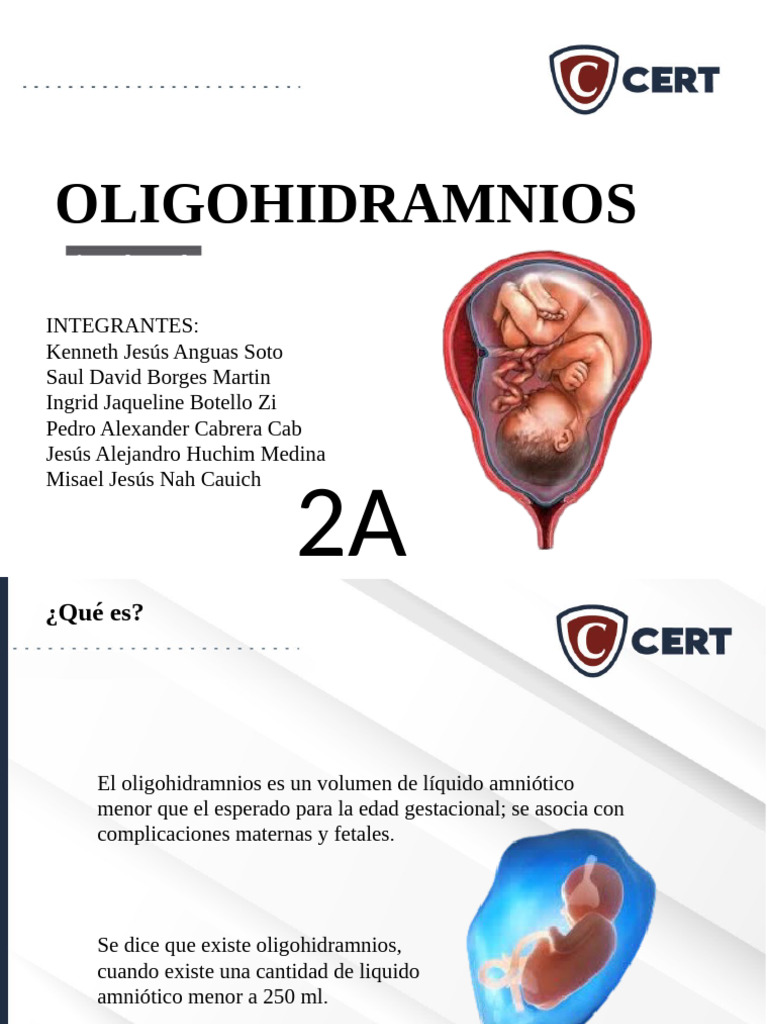 Clasificación y manejo del oligohidramnios | PDF | Parto | Feto