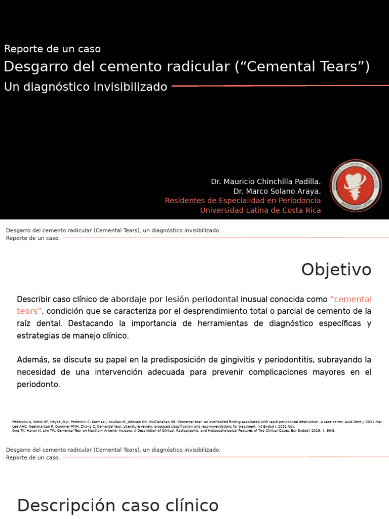 Diagnóstico y manejo de Cemental Tears | PDF | Odontología ...