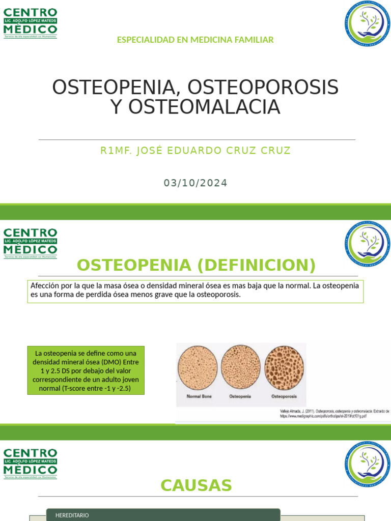 Osteopenia, Osteoporosis | PDF | Osteoporosis | Hueso