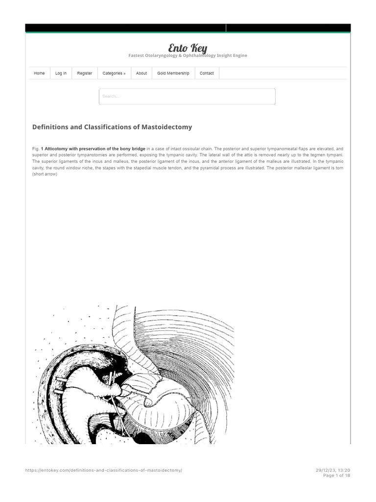Definitions and Classifications of Mastoidectomy - Ento Key | PDF | Ear | Human Head And Neck