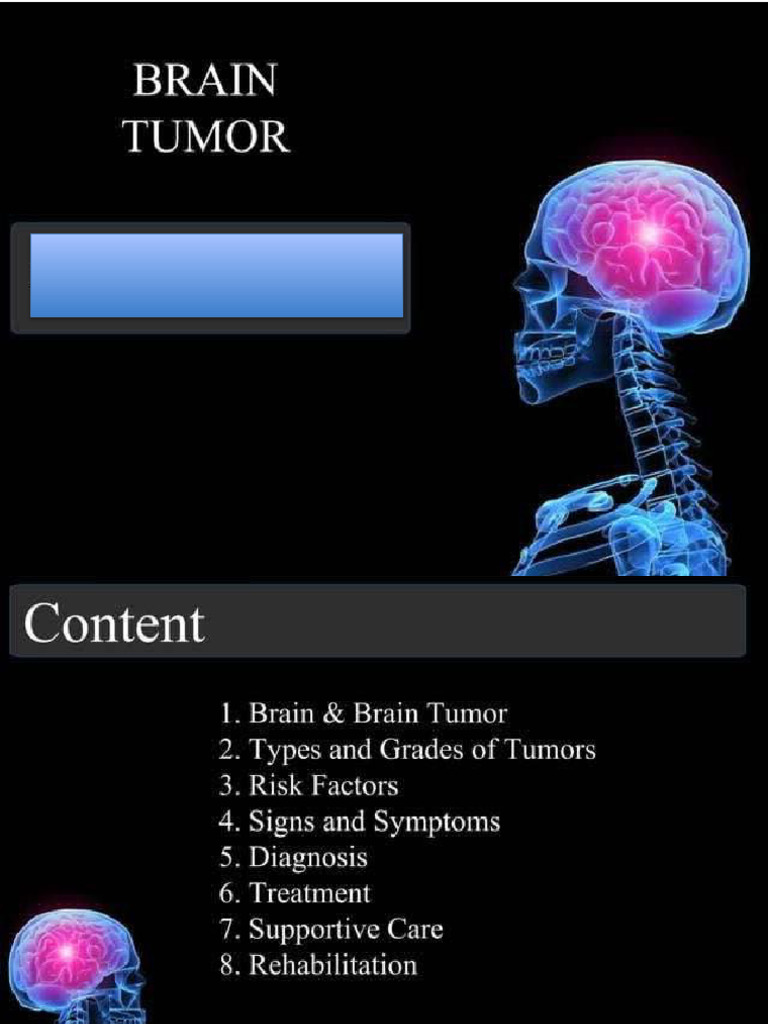 Brain Tumor Intrancranial Tumor | PDF