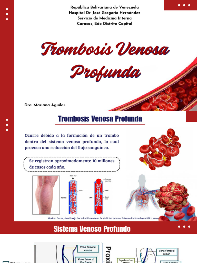 TVP Diapositiva | PDF | Trombosis | Medicina CLINICA