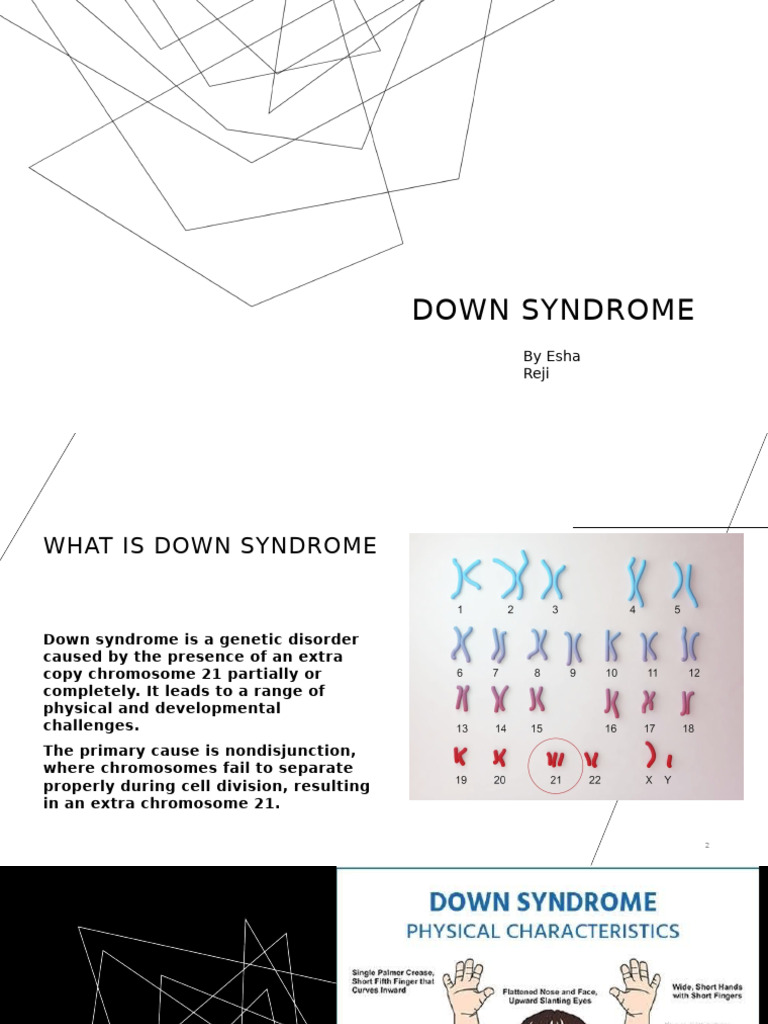 Down Syndrome | PDF | Down Syndrome | Medical Specialties