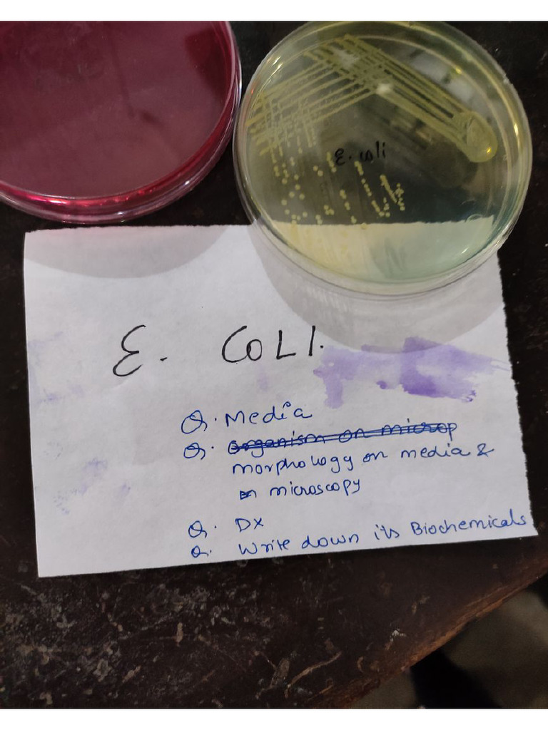 E coli | PDF