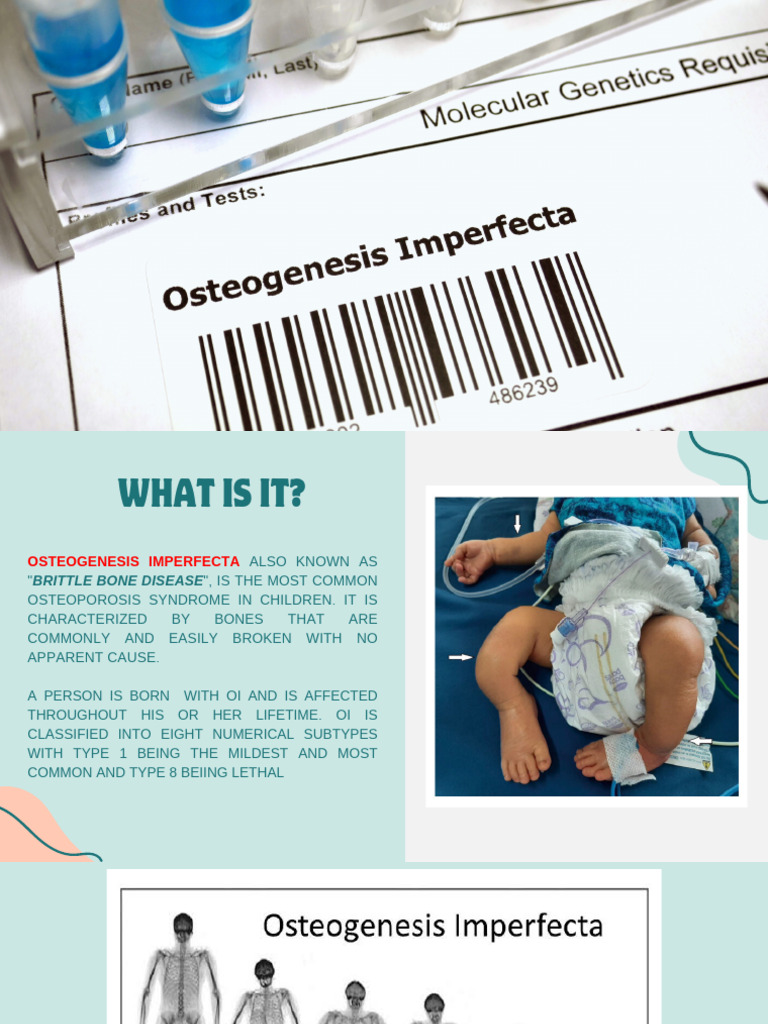 Osteogenesis Imperfecta | PDF | Bone | Diseases And Disorders