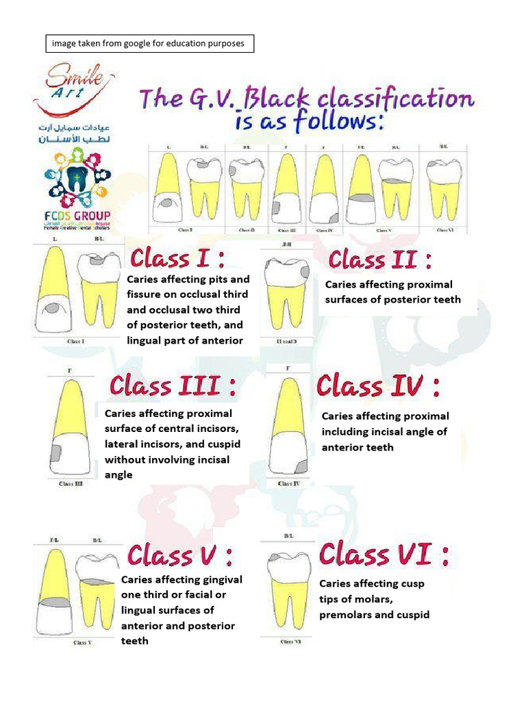 GV Black Classification | PDF