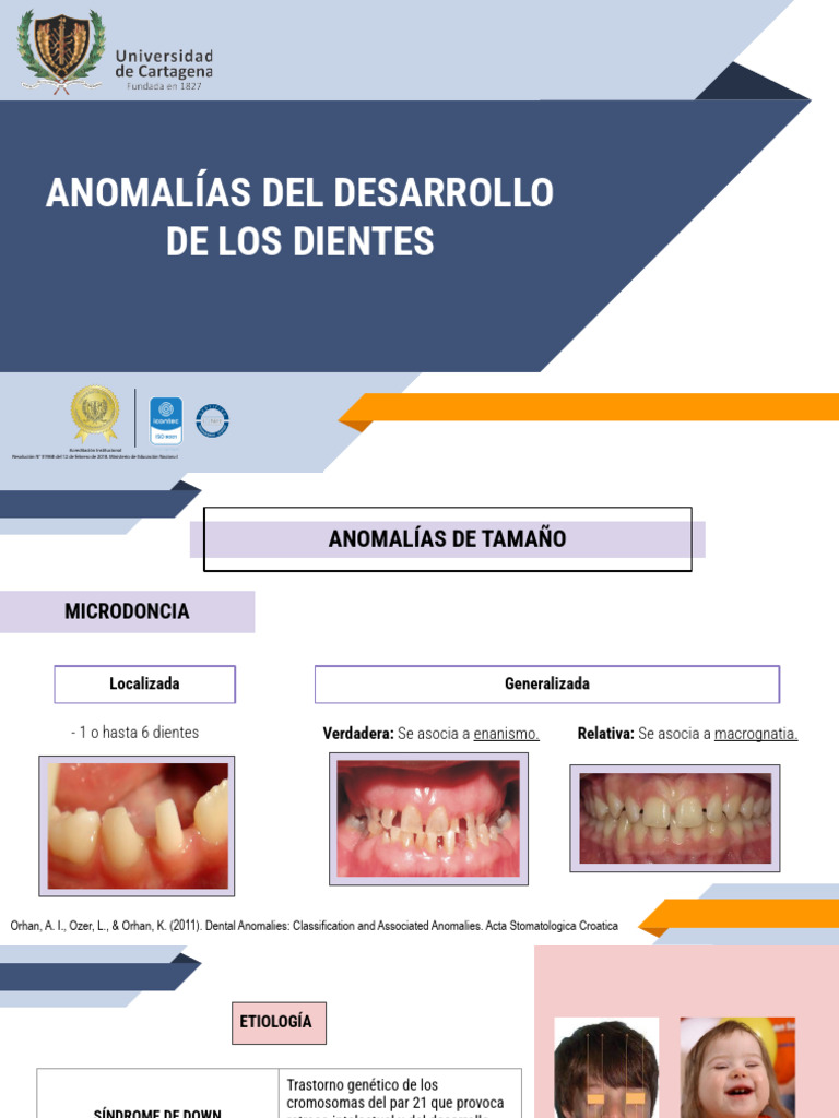 Anomalías del desarrollo | PDF | Diente | Boca