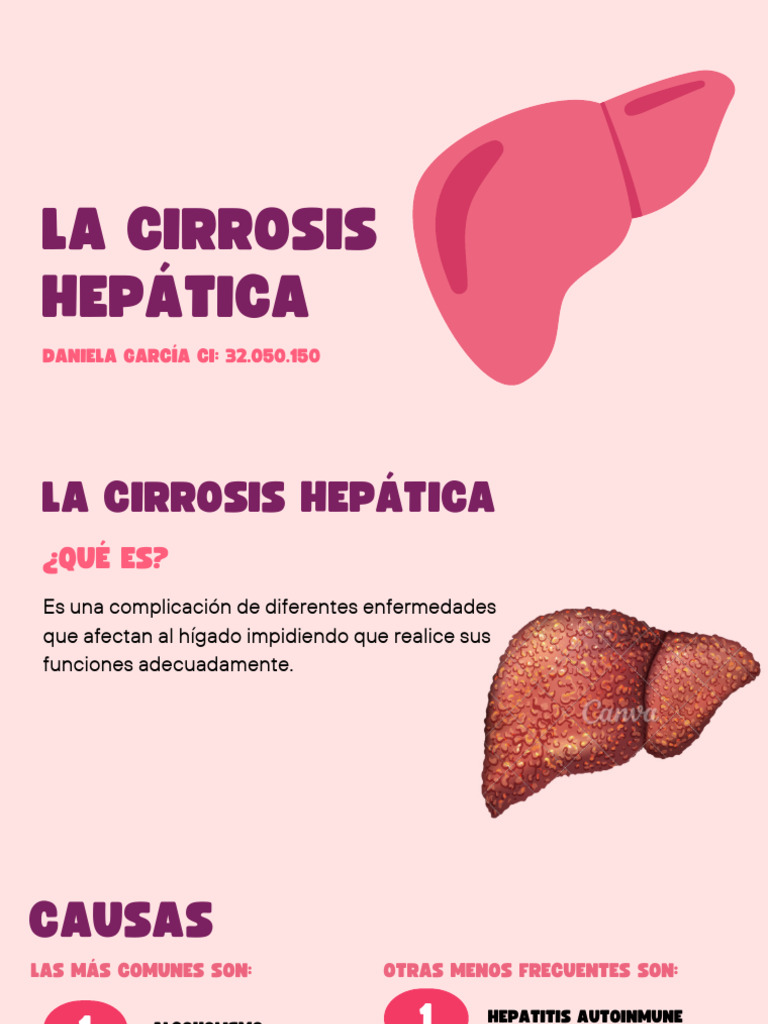 Presentación Cirrosis Hepatica | PDF | Cirrosis | Hepatitis