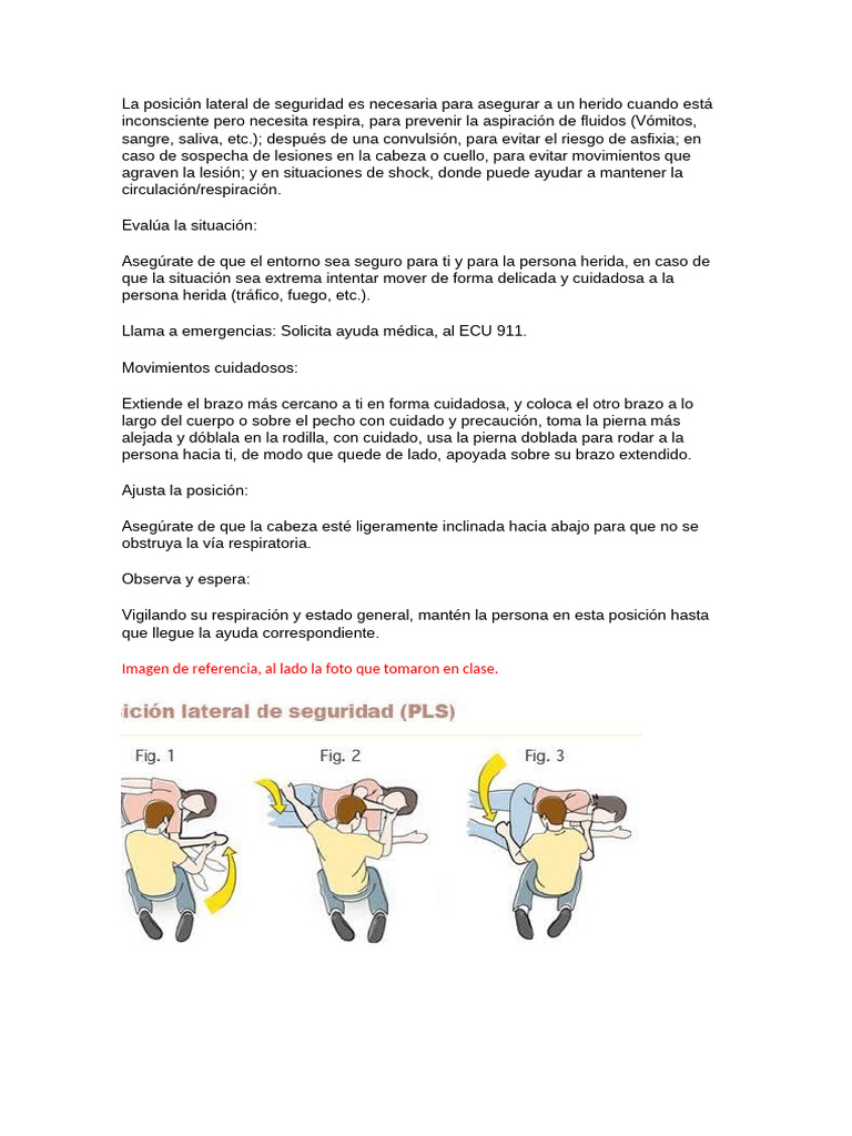 Posicion Lateral | PDF