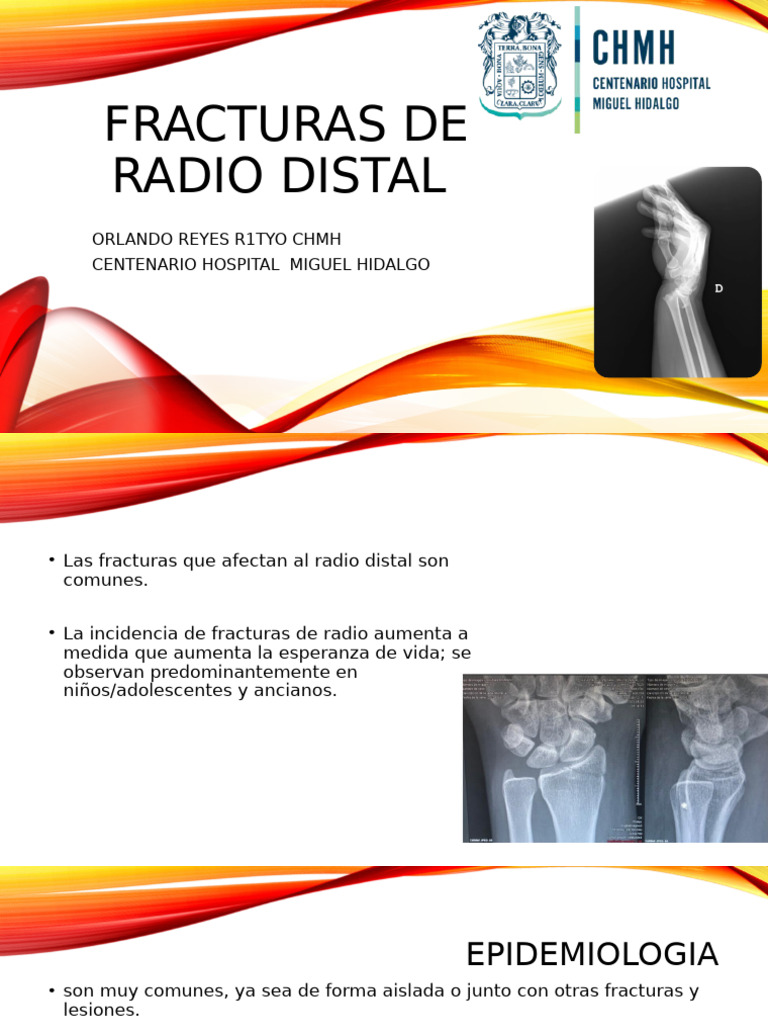 Fracturas de Radio Distal | PDF | Mano | Síndrome del túnel carpiano