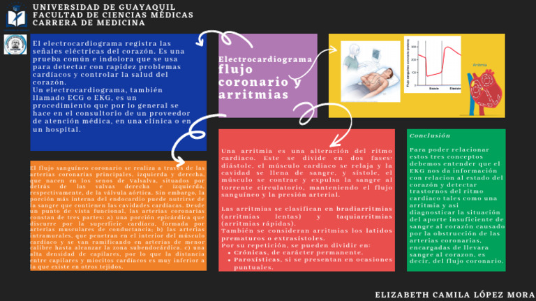 Esquema Electrocardiograma, Flujo Coronario y Aritmias | PDF | Corazón ...