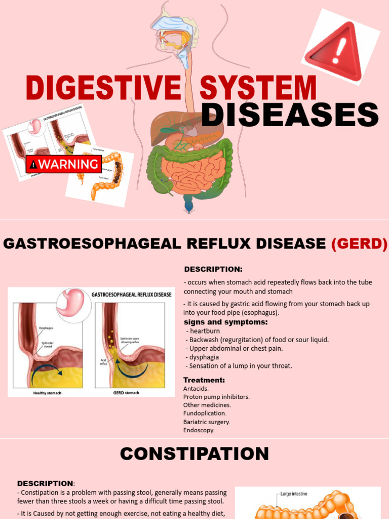 Digestive System Diseases Overview | PDF