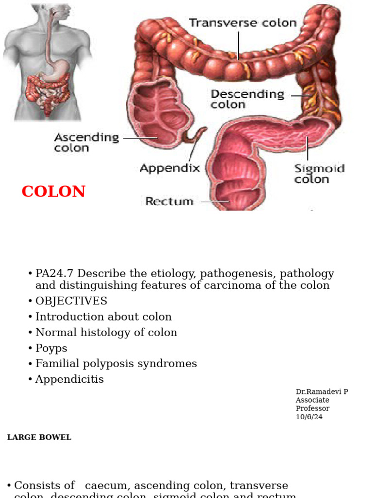 Polyps | PDF | Adenoma | Colorectal Cancer