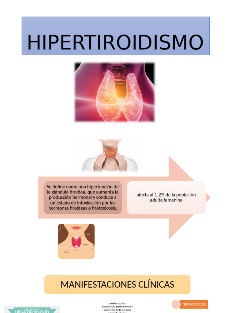 HIPERTIROIDISMO | PDF | Hipertiroidismo | Tiroides