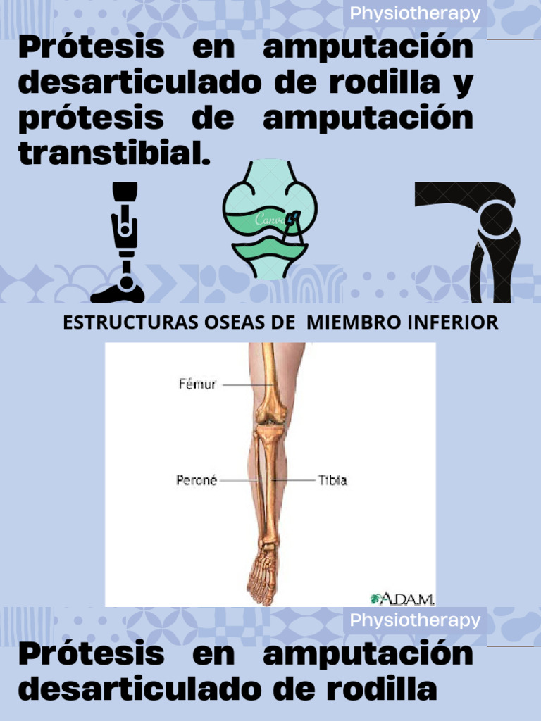 Prótesis en Amputación Desarticulado de Rodilla y Prótesis de ...