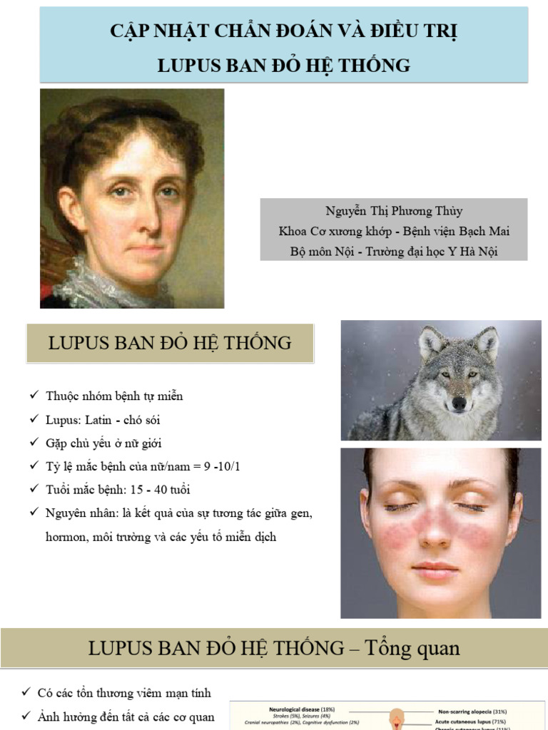 LEC22.S3.2. Lupus ban đỏ hệ thống | PDF