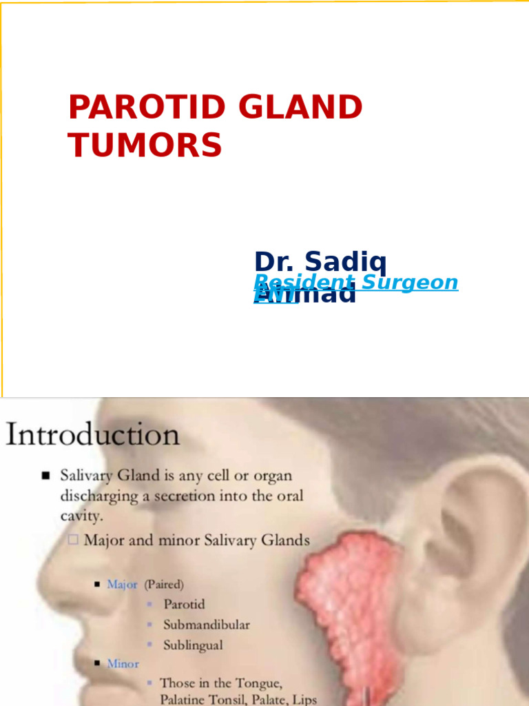 Parotid Gland Tumors Dr. Sadiq ENT | PDF