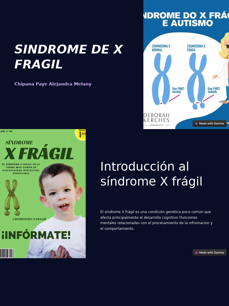 Sindrome de X Fragil | PDF | Enfermedades y trastornos | Medicina CLINICA