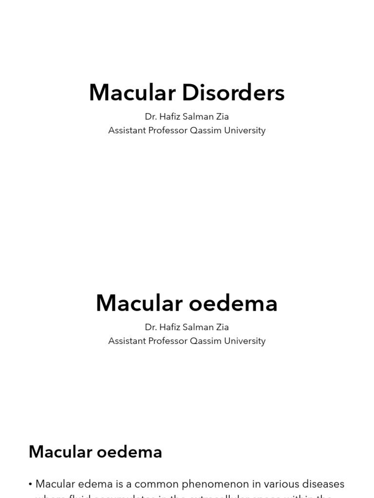Macular Disorders VMT | PDF | Edema | Ophthalmology
