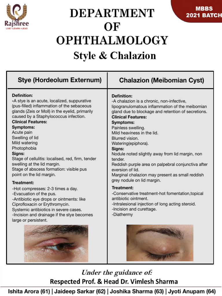 Ophthalmology Poster Stye & Chalazion 61-64 | PDF