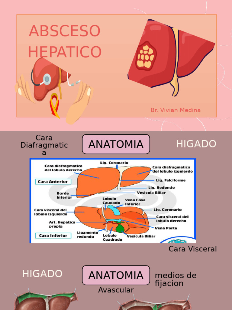 Absceso Hepático: Anatomía y Tratamiento | PDF | Hígado ...