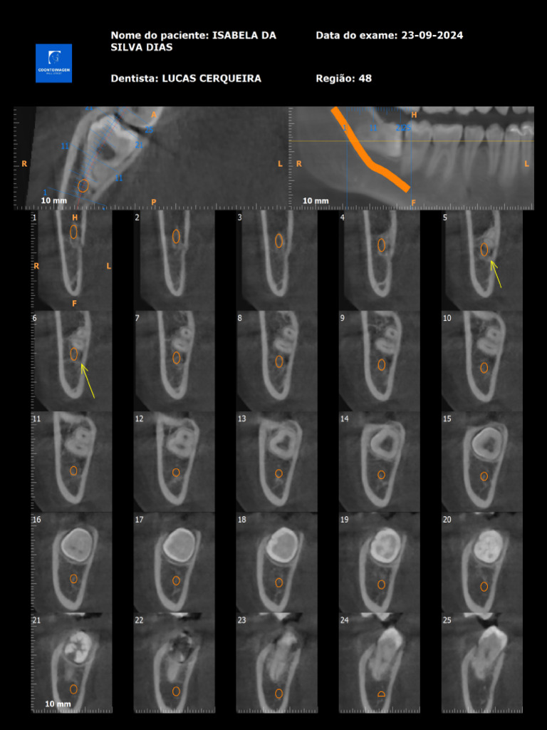Isabela Da Silva Dias.48 | PDF