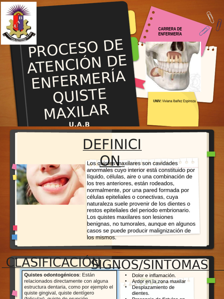 Quiste Maxilar | PDF | Antiinflamatorio | Medicamentos con receta