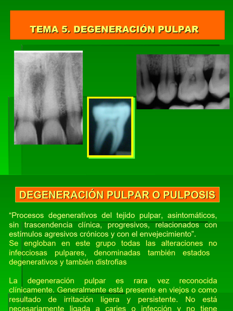 Degeneración Pulpar: Tipos y Diagnóstico | PDF | Atrofia | Inflamación