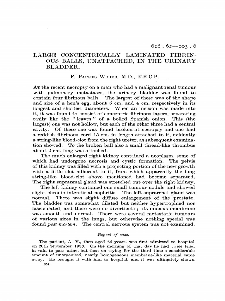 2 Large Concentrically Laminated Fibrinous Balls, Unattached, in The ...