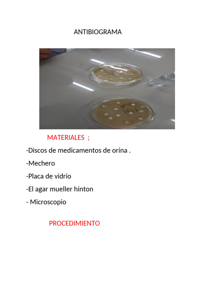 Procedimiento de antibiograma en sangre | PDF | Sangre | Anatomía