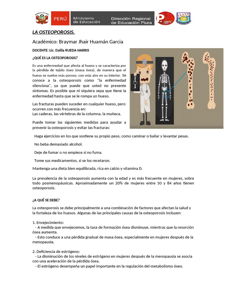 Osteoporosis BRAYMAR HUAMAN GARCIA... | PDF | Osteoporosis | Hueso