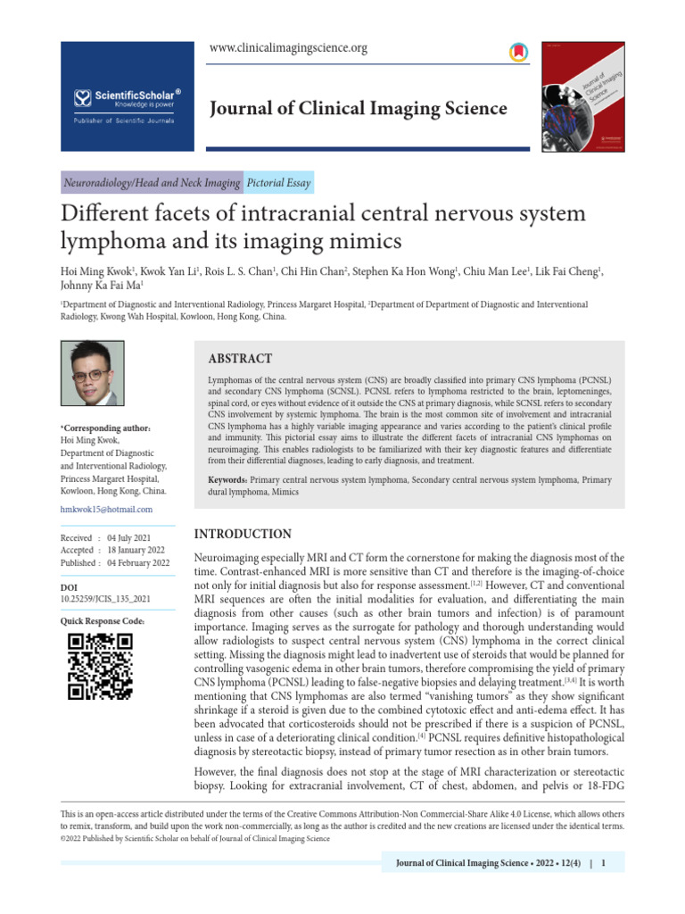 Different Facets of Intracranial Central Nervous System Lymphoma and Its Imaging Mimics | PDF ...
