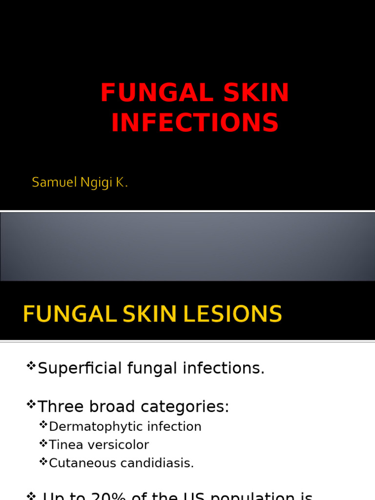 Fungal Skin Infections | PDF | Diseases And Disorders | Medical Specialties