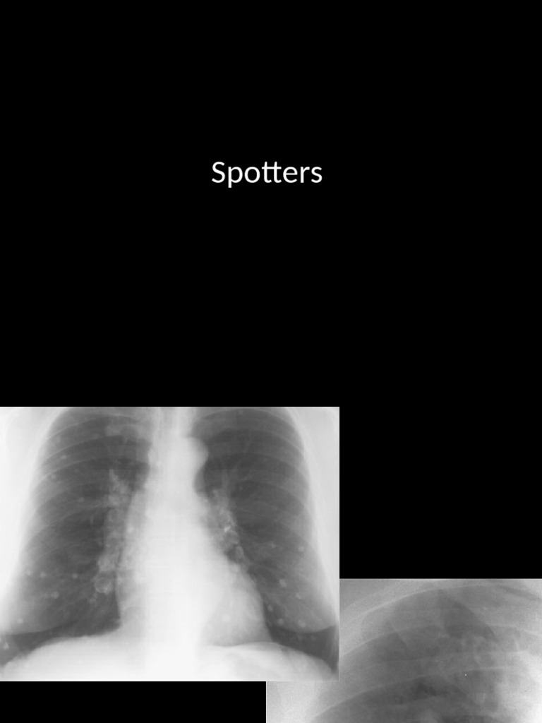 Spotters | PDF