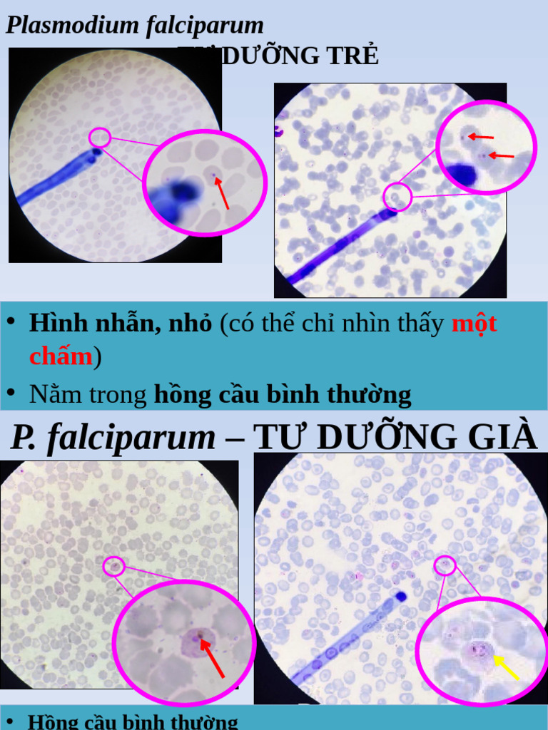 KST SỐT RÉT | PDF