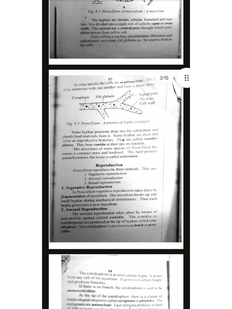 Neet short cards | PDF