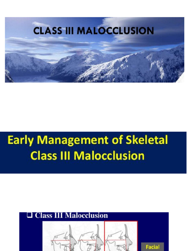 Ćw. 4-Class III Malocclusion | PDF