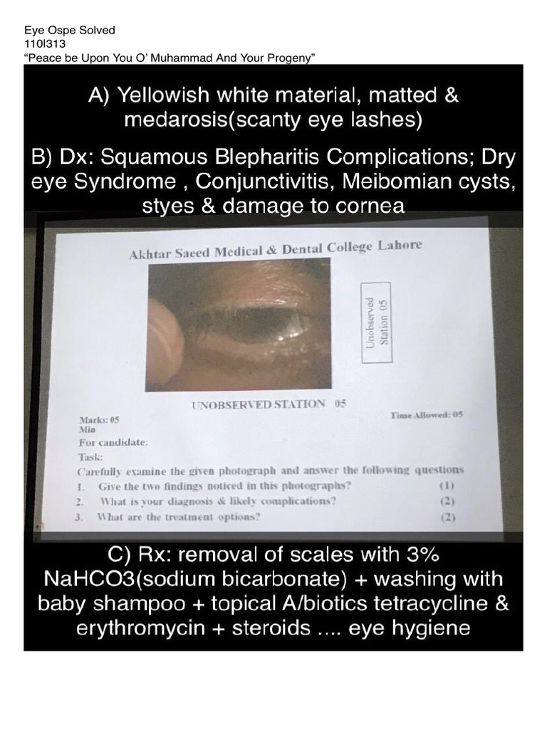 Eye Ospe Solved-1 | PDF
