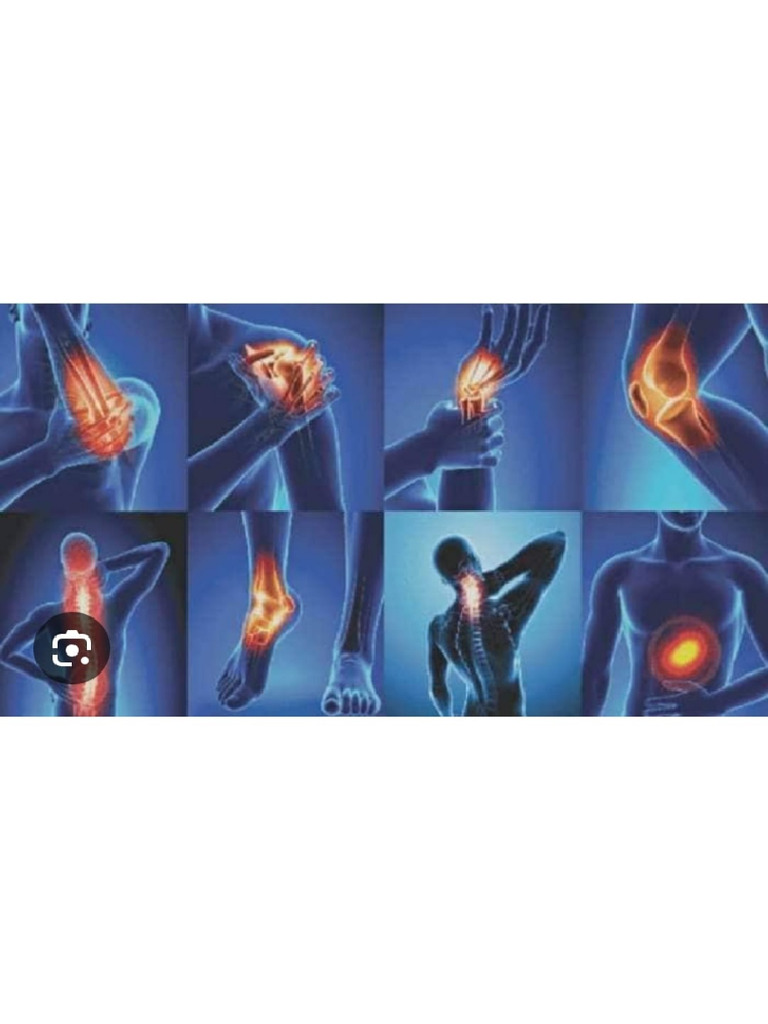 Joint pain | PDF