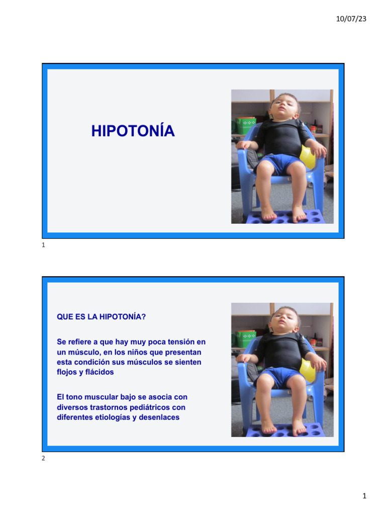 6 Hipotonia | PDF | Pelvis | Bipedalismo