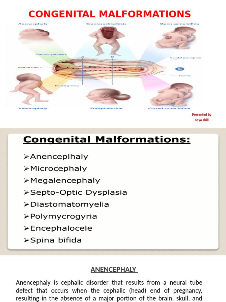 Congenital Malformations | PDF | Self-Improvement | Wellness