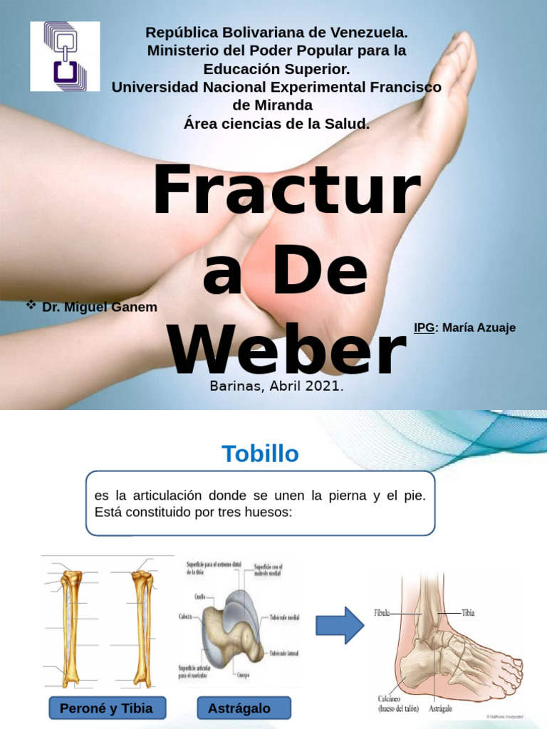 Fx Traumatologia | PDF | Tobillo | Articulación