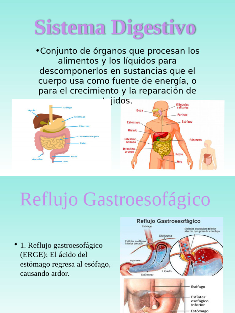 Trabajo Mejorado de RONNIE | PDF