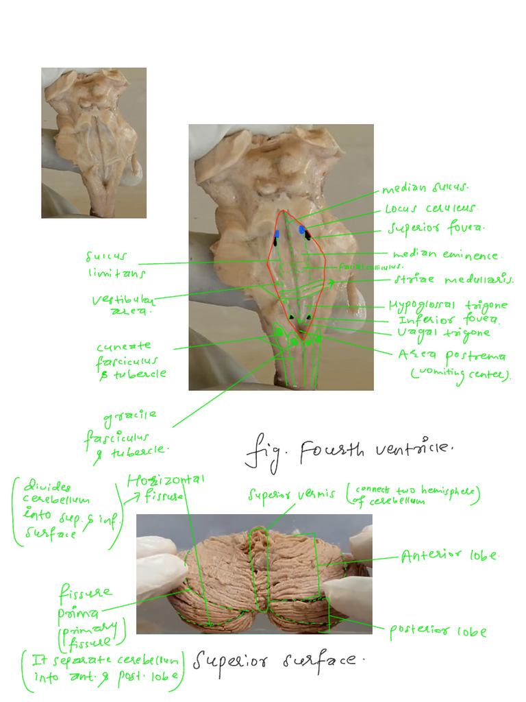 Cerebellum and 4th Ventricle | PDF