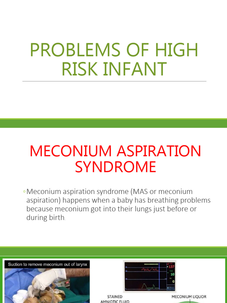 Problems of High Risk Infant | PDF