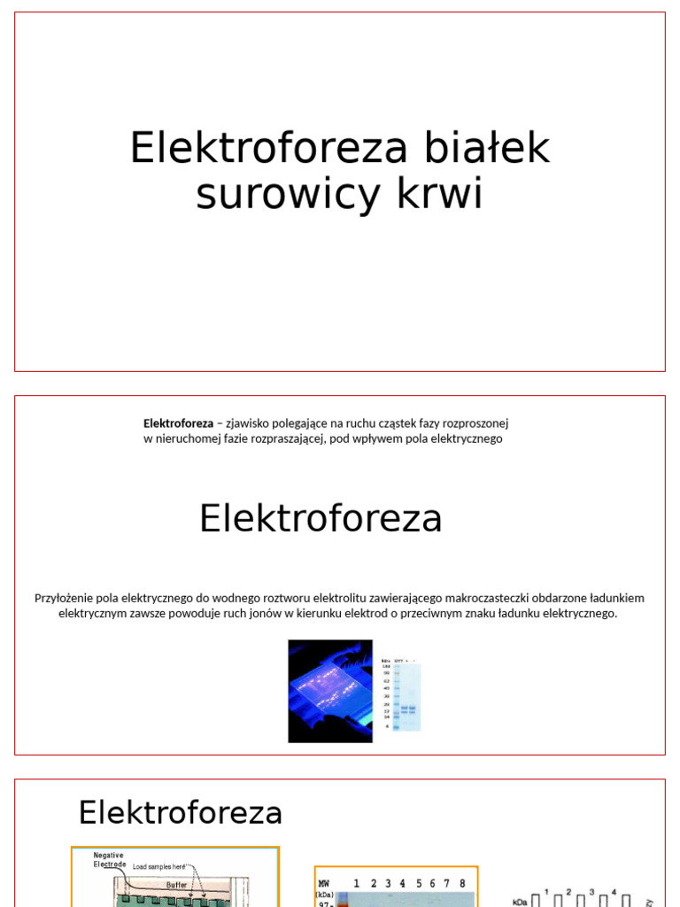 Prezentacja Elektroforeza Białek Surowicy Krwi | PDF