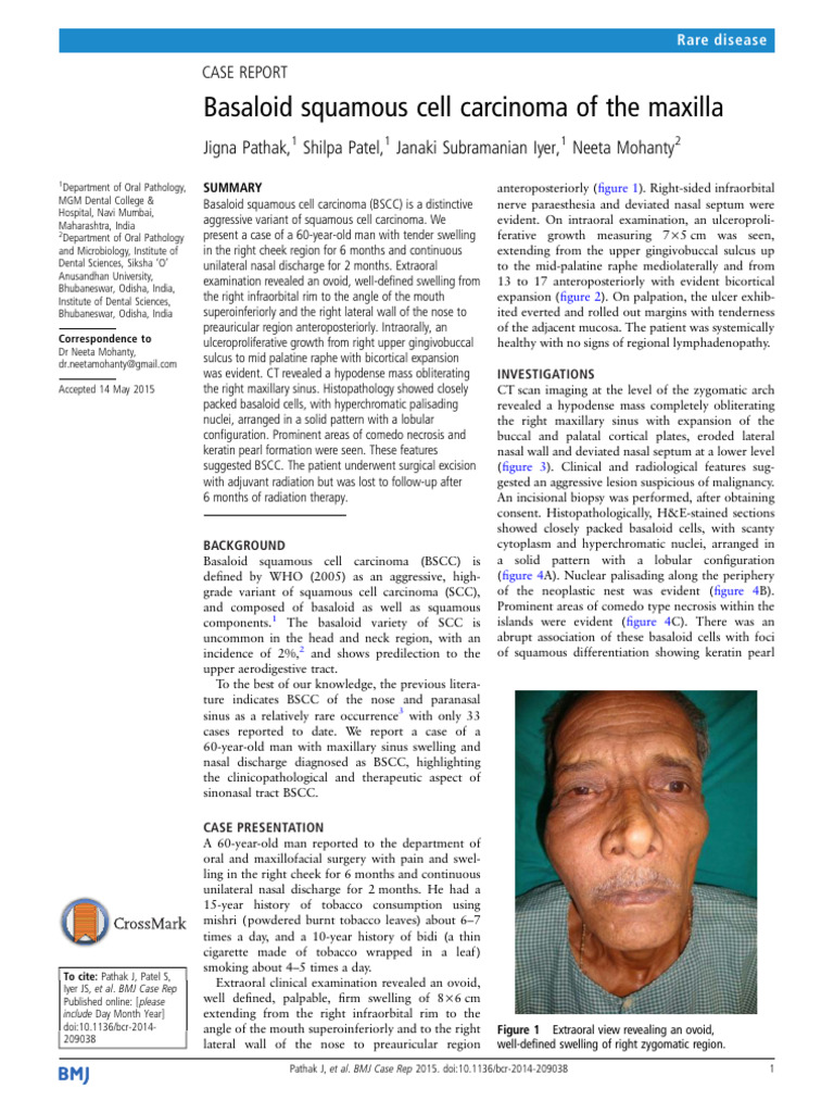 Basaloid Squamous Cell Carcinoma Case | PDF | Human Nose | Head And ...