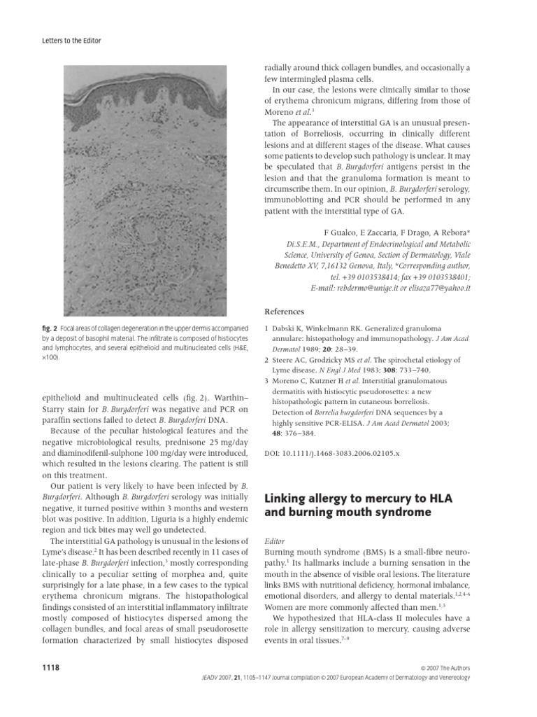 Allergy o Mercury and HLA | PDF | Scanning Electron Microscope | Lyme ...