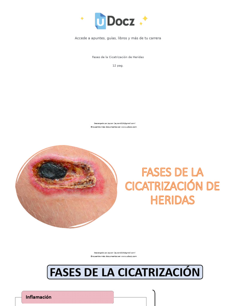 Fases de Cicatriz | PDF | Inflamación | Cicatrización de la herida
