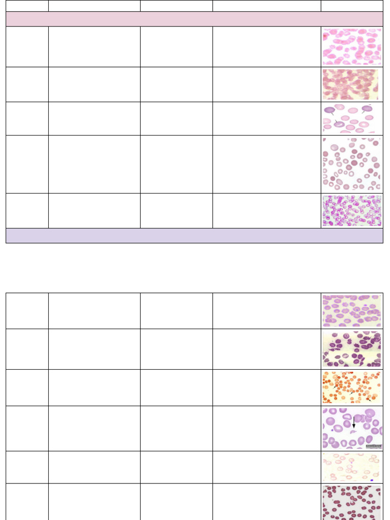 Poiquilocitos | PDF | Glóbulo rojo | Anemia